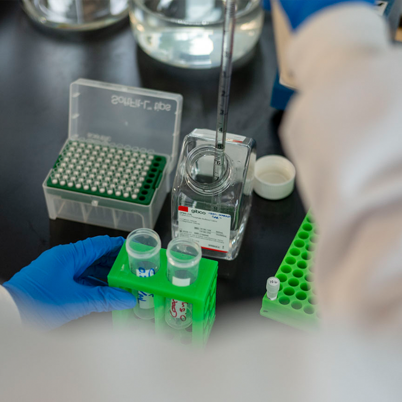 Immunoanalytical Solutions | ELISA & Enzyme Assays